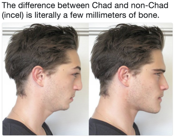 Chin - Incel Wiki